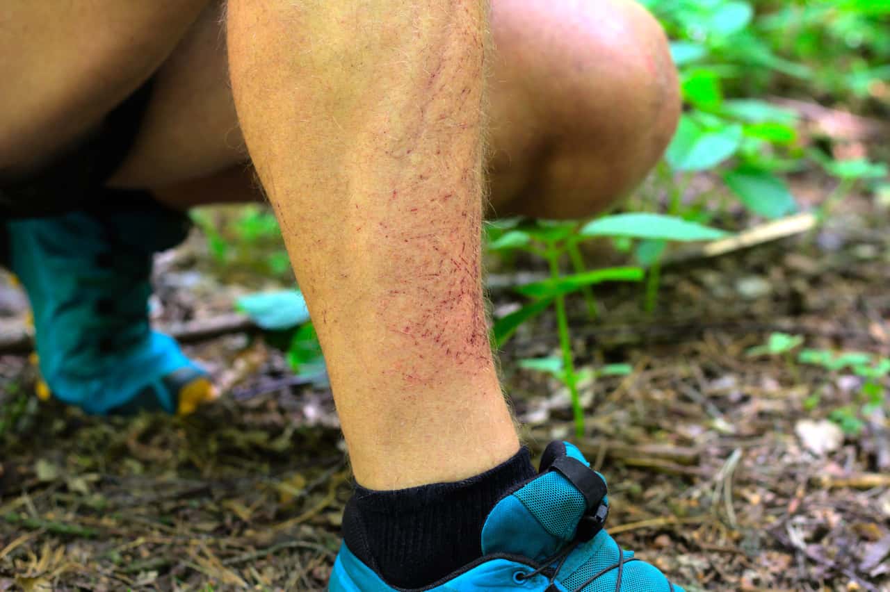 Sepsis vorbeugen: Grippe- und Pneumokokken-Impfung für Landwirte ...